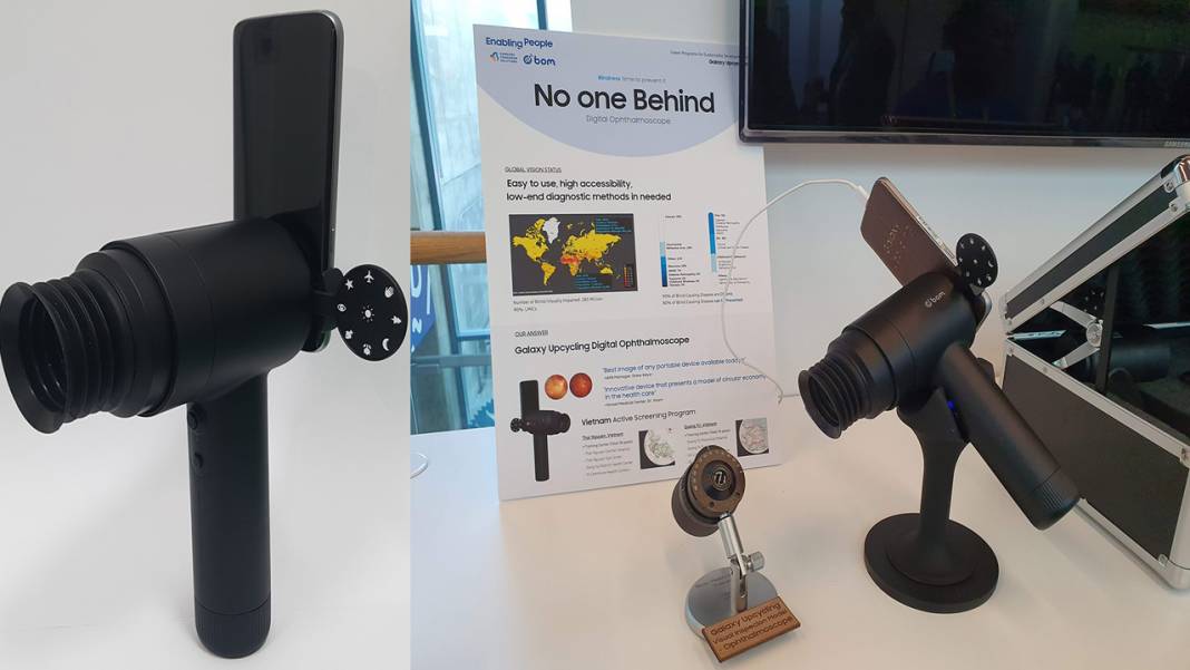 Samsung uses Galaxy phones as fundus camera for cost-effective eye care ...